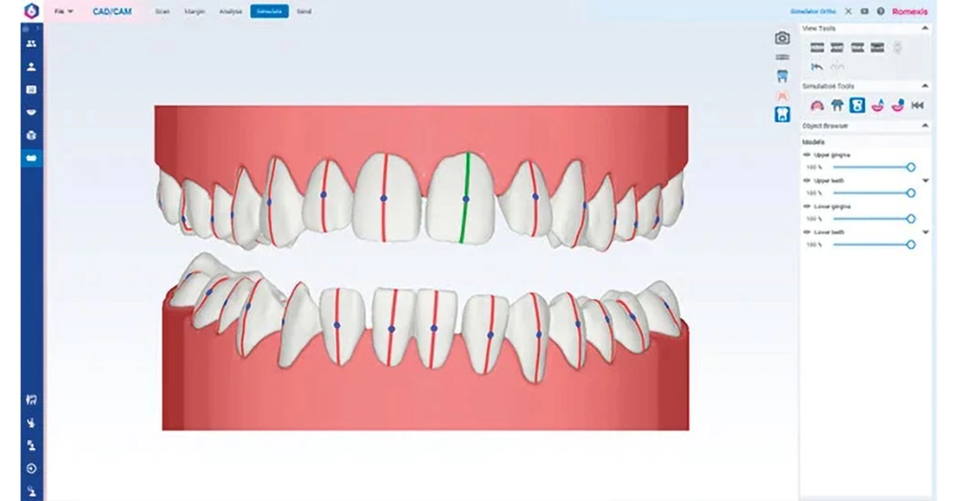 Romexis Ortho Simulator - Planmeca