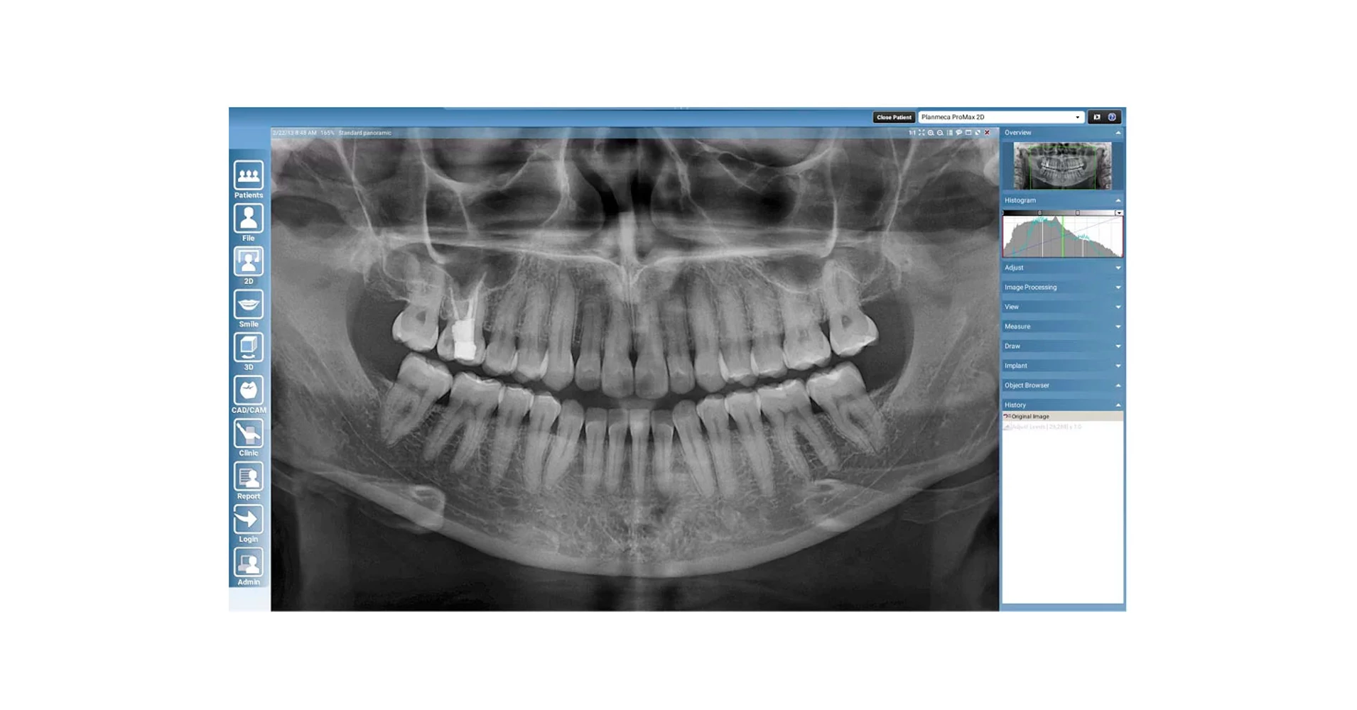 Romexis 2D Standard - Planmeca